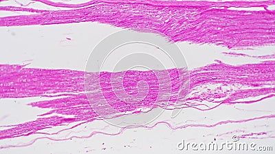 Nerves Trunk of a Human Being in Longitudinal Section Magnified with ...
