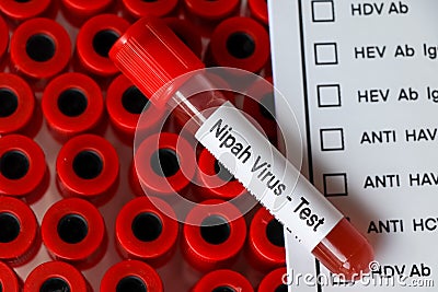 Nipah Virus Test To Look For Abnormalities From Blood Royalty-Free ...