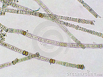 Nodularia Sp. Toxic Algae Under Microscopic View, Nitrogen-fixing Cyanobacteria, Cyanotoxin ...