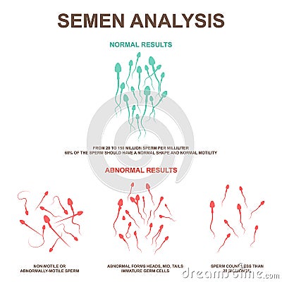 Normal And Abnormal Sperm Stock Photo | CartoonDealer.com #63722209