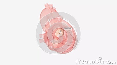 Normal Aortic valve . stock video. Video of chest, septum - 266195127