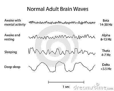 Normal Brain Waves EEG Royalty Free Stock Photo - Image: 29444815