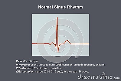 A Normal Electrocardiogram, 3D Illustration | CartoonDealer.com #281461723