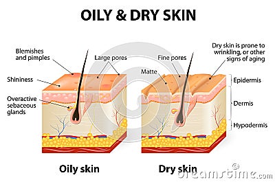Olieachtige & Droge Huid Vector Illustratie - Afbeelding: 55852195