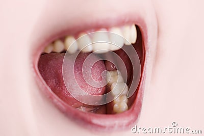 Open Mouth And Teeth Stock Images - Image: 9461714