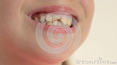 Opening His Mouth. the Child S Front Teeth are Knocked Out Stock ...