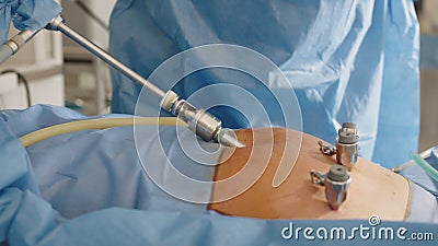 In the Operating Room, the Doctor Does a Laparoscopy. Endoscopy. Close ...