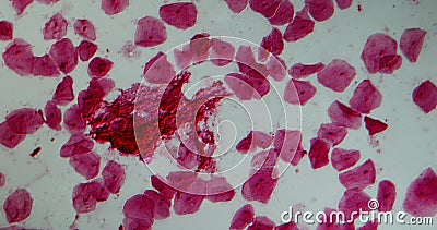 Oral Mucosa, Epithelial Tissue Stock Footage - Video of digestion ...