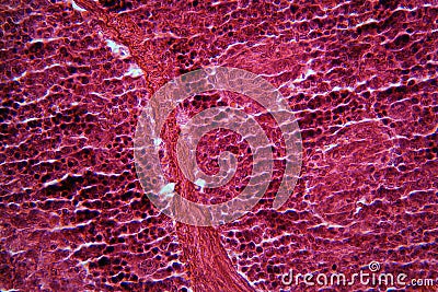 Pancreas Cells Under The Microscope Stock Image | CartoonDealer.com ...