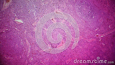 Pancreas Section Under The Microscope Stock Photo | CartoonDealer.com ...