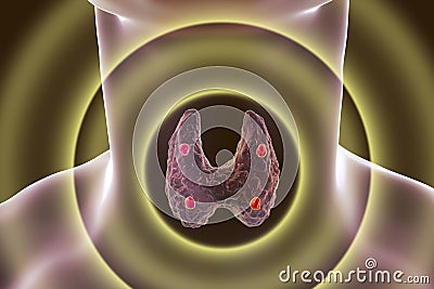 Parathyroid Glands Anatomy Royalty-Free Cartoon | CartoonDealer.com ...