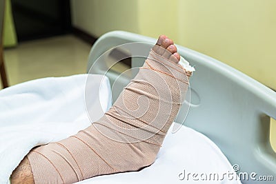Patient With Broken Leg In Cast And Bandage Stock Photo - Image: 43174234