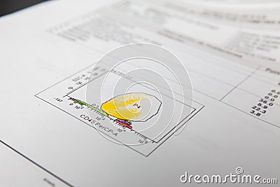 Patient Flow Cytometry Test Report. Flow Cytometry Editorial Image ...