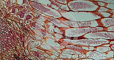Plant Bile on Leaf in Cross-section Stock Footage - Video of ...