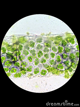Plant Cell With Chloroplast Under Microscope Stock Photo ...