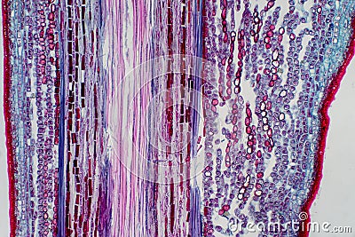 Plant Vascular Tissue Under The Microscope View Stock Photography ...