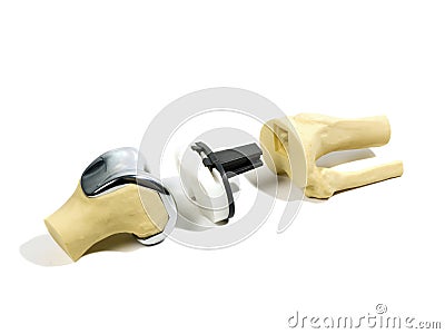 Plastic Model Of A Knee Replacement Royalty Free Stock Photo - Image ...