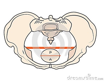 Platypoid Or Platypelloid Pelvis Shape W Round Or Circular Shape ...