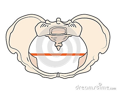 Platypoid Or Platypelloid Pelvis Shape W Round Or Circular Shape ...