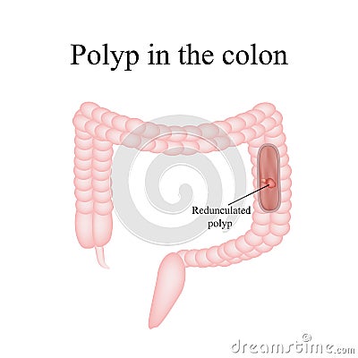 Intestine Diagram Stock Illustrations – 4,091 Intestine Diagram Stock ...