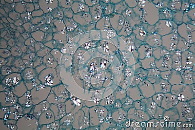 Potato Cells With Starch Corns Under The Microscope Stock Photo ...