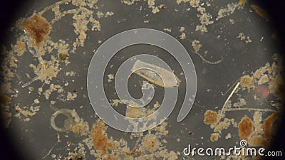 Priapulid larva stock video. Video of priapulus, worm - 36494194