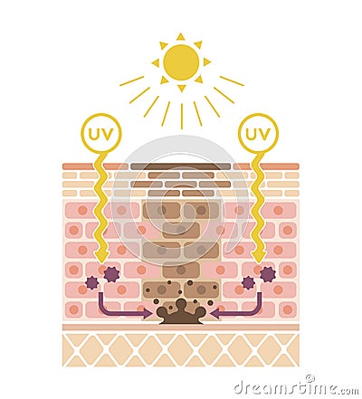 Mechanism Of Skin Pigmentation Illustration Cartoon Vector ...