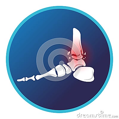 Fracture Ankle Icon. Vector Flat Design For Radiology Orthopedic ...