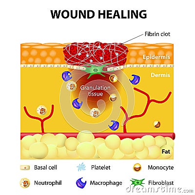 Process Of Wound Healing Cartoon Vector | CartoonDealer.com #51251717