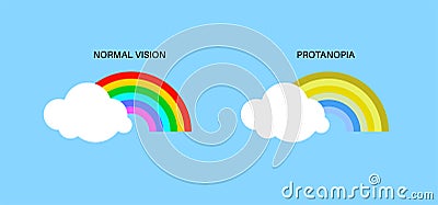 Protanopia And Normal Vision Vector Illustration | CartoonDealer.com ...