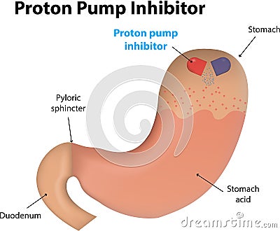 Proton Pump Inhibitor Cartoon Vector | CartoonDealer.com #42979375