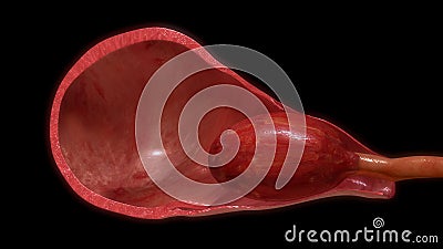 Pulling Placenta Out Of Uterus Royalty-Free Stock Image | CartoonDealer ...