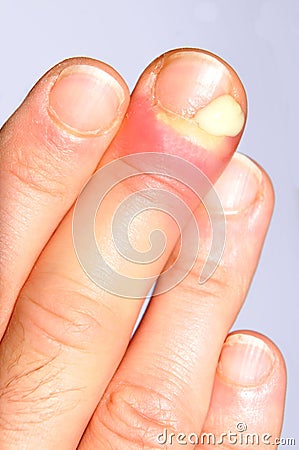 Puss Stock Photo - Image: 58388630