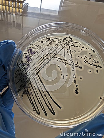 Quadrant Streak Of Staphylococcus Aureus On Baird Parker Agar Plate ...