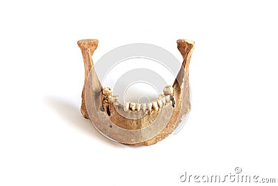 Quijada Humana Imagen de archivo - Imagen: 5468051