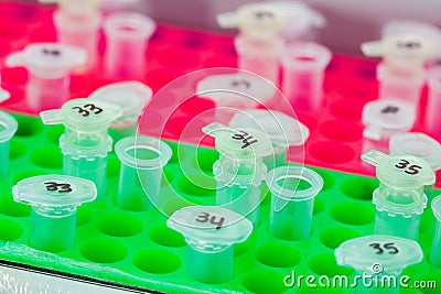 Rack Of Test Tubes Being Used For DNA Extraction Using The Spin Column ...