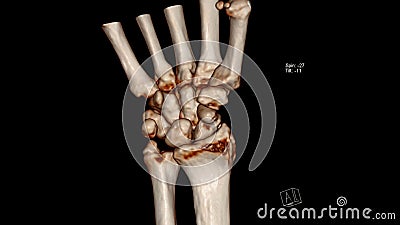 Radiology Examination, Computed Tomography Volume Rendering Examination ...
