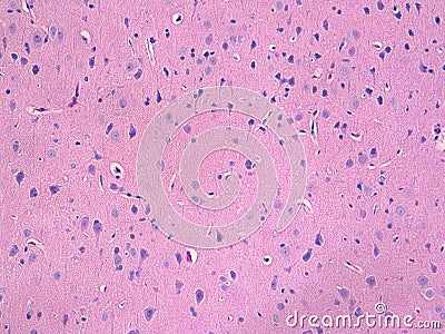 Rat Brain (H&E) Stock Illustration - Image: 40681409