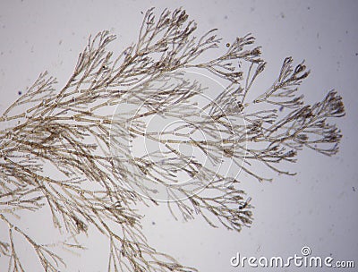 Red Algae Under The Microscope Royalty-Free Stock Photo | CartoonDealer ...