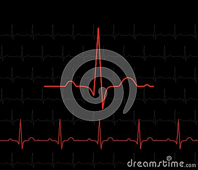 Red EKG Symbol On Black - Medical Background Stock Photo - Image: 38223010