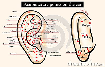 Reflex Zones On The Ear. Acupuncture Points On The Ear. Map Of A ...