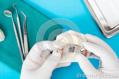 Removable Partial Denture RPD. Royalty-Free Stock Photo | CartoonDealer ...