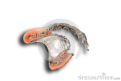 Removable Partial Metal Swinglock Upper Denture Opened On White ...
