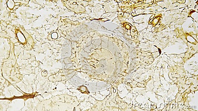 Reticular Tissue of Lymph Node of the Human Being Under Microscope 200x ...