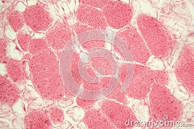 Root Bacteria Nodules Under The Microscope. Stock Photography ...