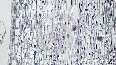 Root Tip of Allium Cepa in Longitudinal Section Magnified by Microscope ...