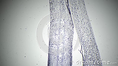 Root Tip of Allium Cepa in Longitudinal Section Magnified by Microscope ...