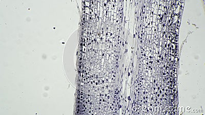 Root Tip of Allium Cepa in Longitudinal Section Magnified by Microscope ...