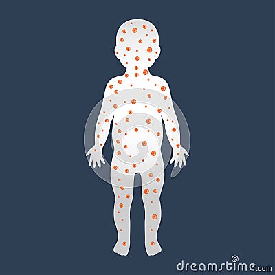 Rubella German Measles Logo Icon Design Cartoon Vector | CartoonDealer ...