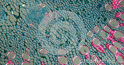 Runner Bean Petiole in Cross Section Stock Footage - Video of ...